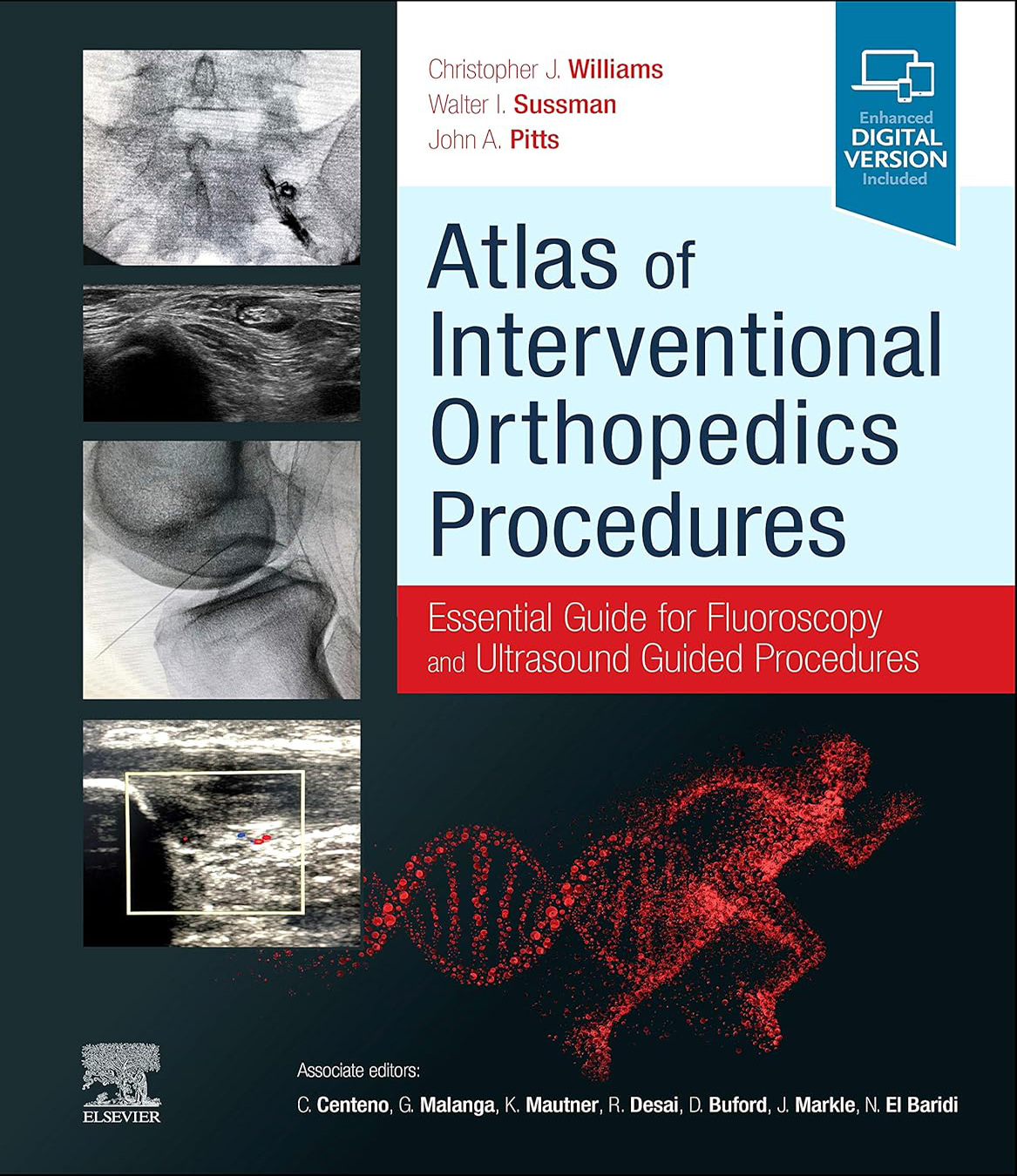 Atlas of Interventional Orthopedics Procedures: Essential Guide for ...